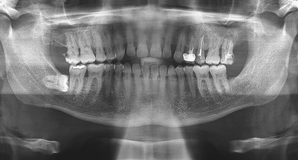 Panorex Imaging - NuttallSmiles